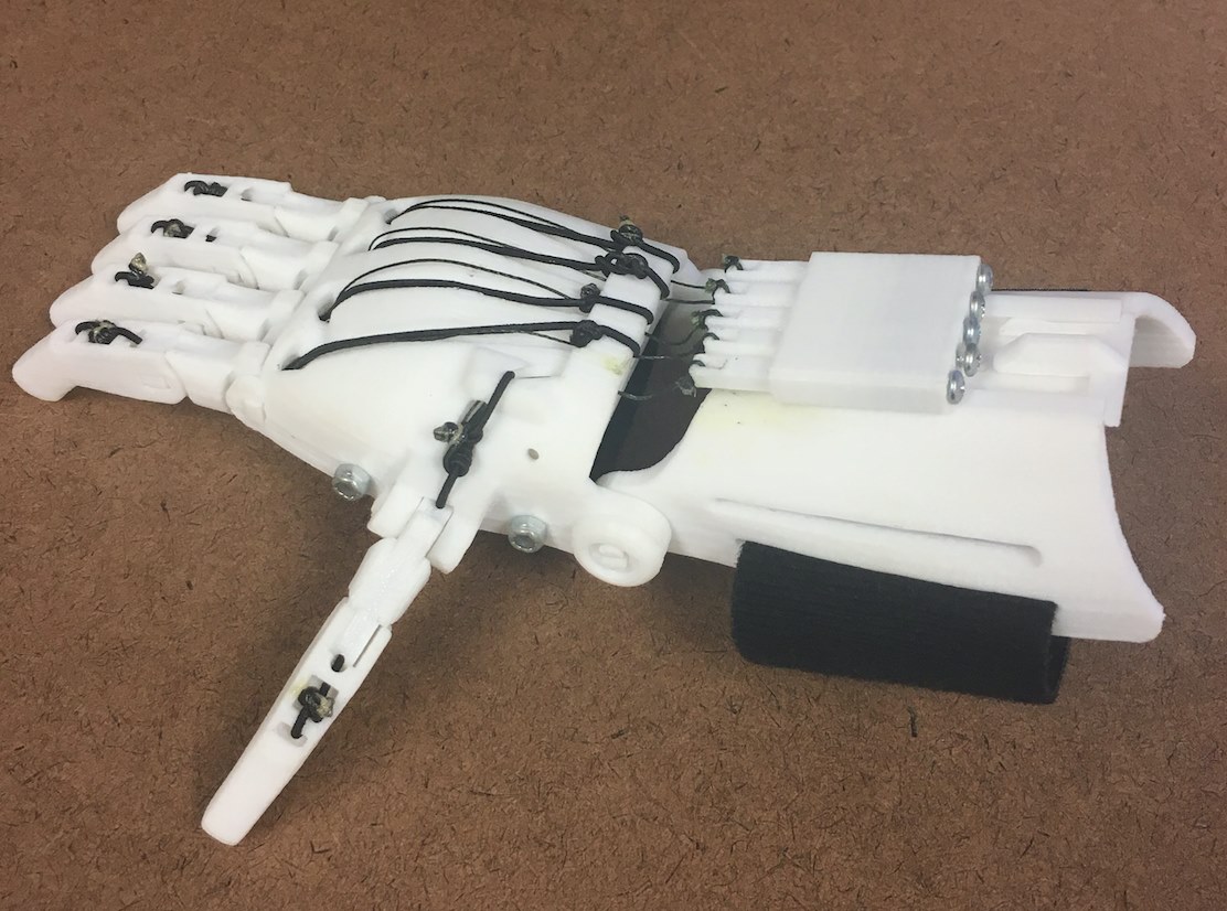 3D-Printed Prosthetic Hands – Anna Grumman: Portfolio