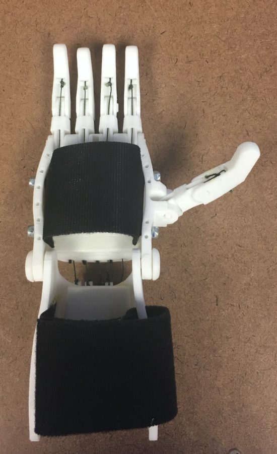 3D-Printed Prosthetic Hands – Anna Grumman: Portfolio